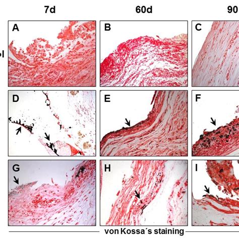 Kinetics Of Tissue Calcification Indu Download Scientific Diagram