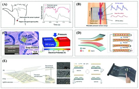 A Comparison Of Normal And Distorted Signals Due To Sensor Download Scientific Diagram