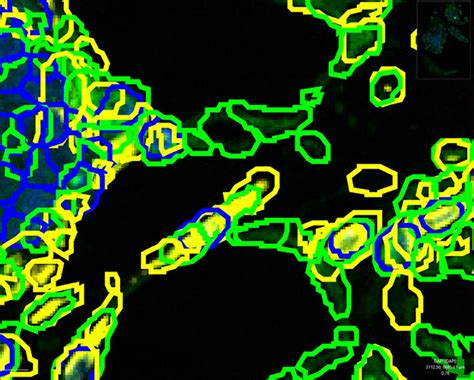 Combine Multiple Cell Segmentations In Cellpose Image Analysis