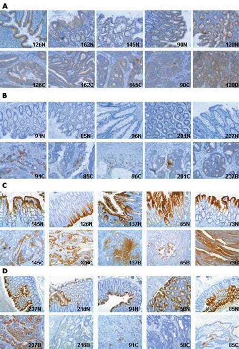 Immunohistochemistry Of Formalin Fixed Paraffin Embedded Sections Of Download Scientific