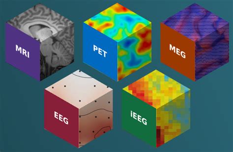 add nirs modality to ui · issue 2712 · openneuroorg openneuro · github