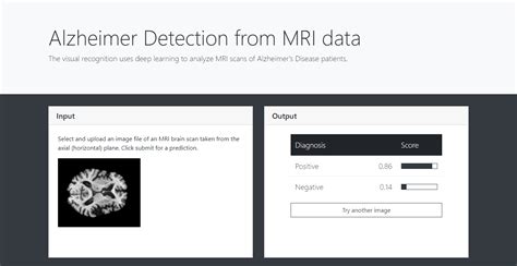 Github Reda97dzalzheimer Detection Webapp