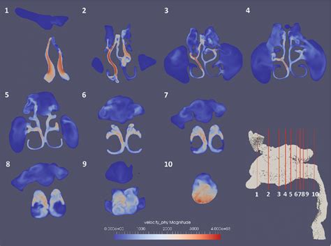 Velocity Magnitude Mms Across Several Cross Sectional Planes