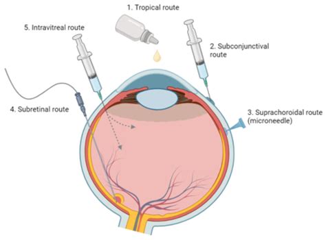 Ijms Free Full Text Exploring The Potential Of Nanoporous Materials For Advancing Ophthalmic