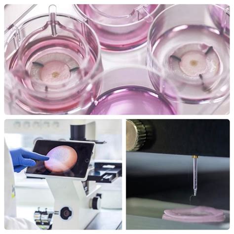 Chanel Has Developed 3D Bioprinted Skin to Improve its Skincare Projects • https://lnkd.in ...