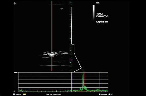 Ultrasonic Testing Ut A Versatile Method For Ndt Inspections