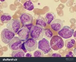 CML Full Form What Is The Full Form Of CML