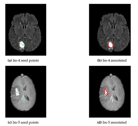 top image segmentation methods for machine vision