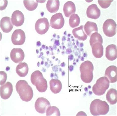 Platelet Aggregation