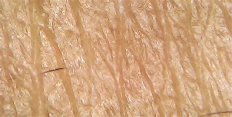 Skin Disease Classification Test Data Kaggle