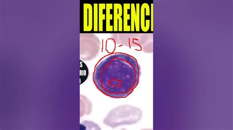 🩸cómo Identificar Al Eritroblasto BasÓfilo ¿cuales Son Sus
