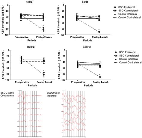 Average Thresholds Of Auditory Brainstem Response Abr In Each Group Download Scientific