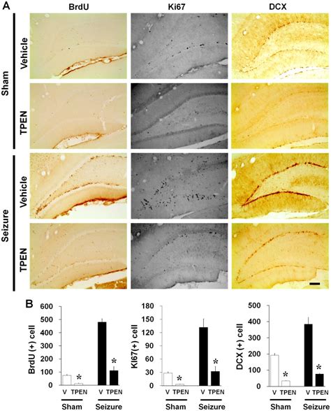 A Light Microscope Images Show Brdu Cells Ki67 Cells And Dcx Download Scientific