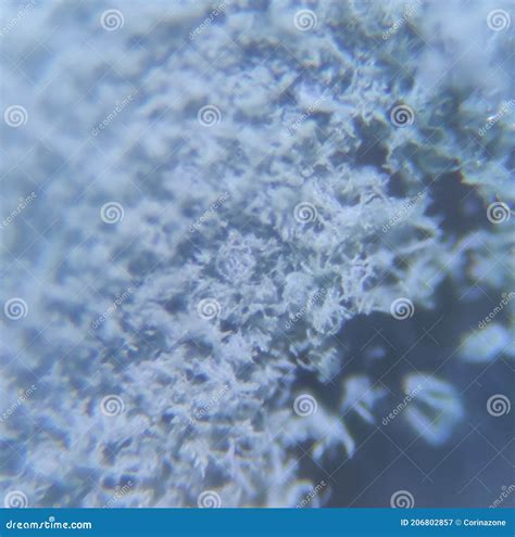 Microscope View Of An Aspergillus Genus Mold Stock Image Image Of