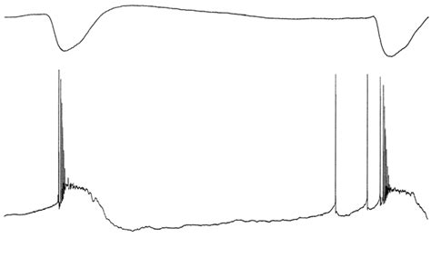 Tentative Representation Of Different Synaptic And Intrinsic Currents Download Scientific