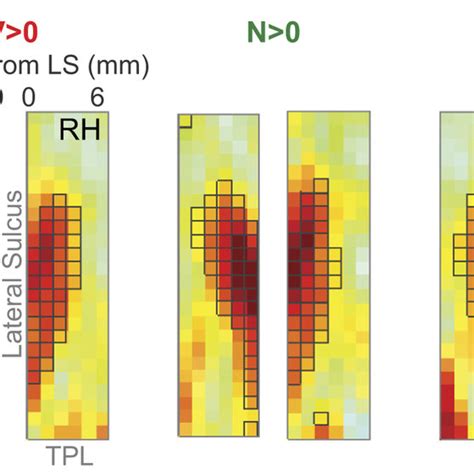 Average Bold Responses To Vocalization Stimuli Across 4 Subjects A Download Scientific