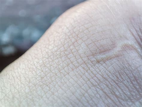 Closeup Macro Skin Pattern Healthy Human Surface Detail Hand Skin