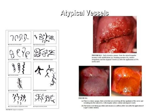 Colposcopy Case Studies2