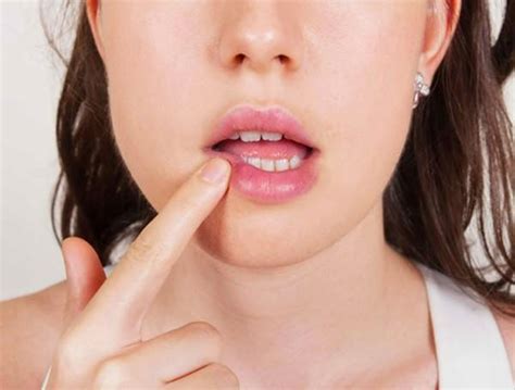 Giải đáp Bị Nổi đẹn Trong Miệng Làm Sao Hết Phụ Nữ And Gia Đình