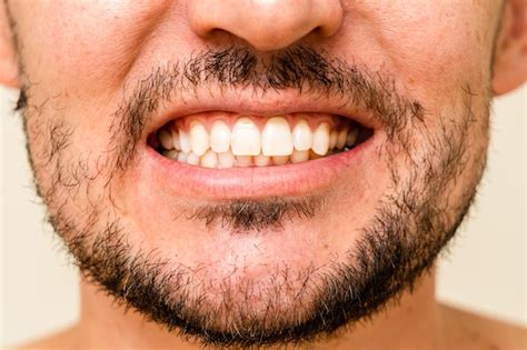 Premium Photo Close Up Of Mans Teeth Before And After Whitening And