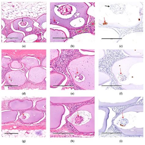 Hande Staining Or Insulin Immuno Staining Sections Of Microcapsules 28