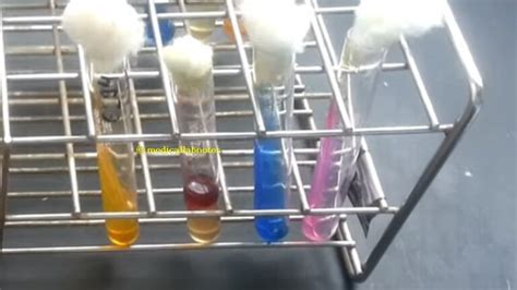 Cholera Introduction Causative Agent Pathogenicity Symptoms