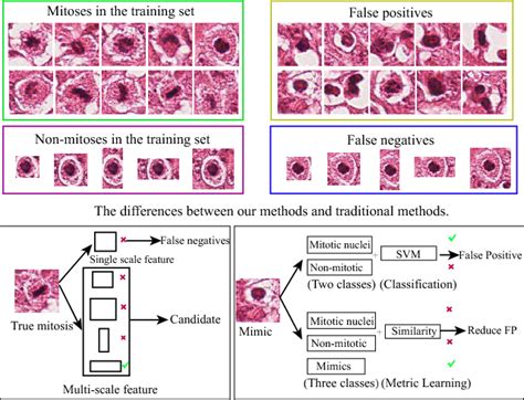 Figure 1 From A Novel Two Stage Deep Method For Mitosis Detection In