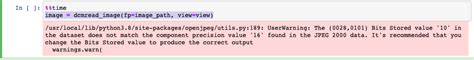 Error With Running Read Dicom Image Following Your Guide In Github