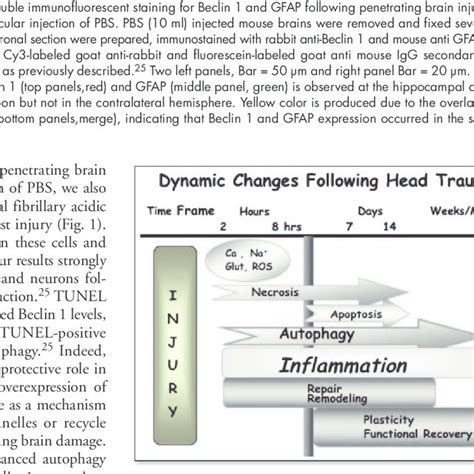 A Proposed Temporal Model Of The Dynamic Changes That Follow Traumatic Download Scientific