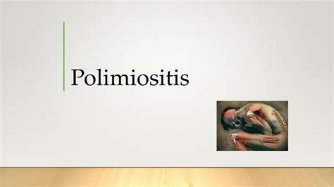 Polimiositis Celeste Codutti Udocz