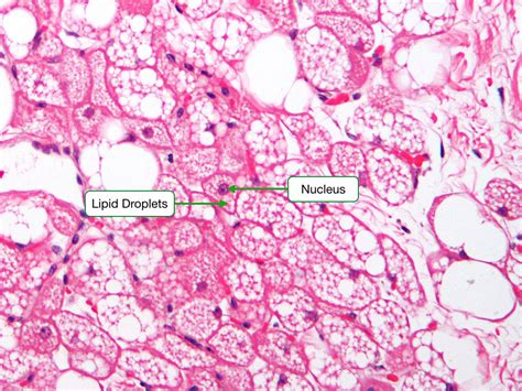 Example Of Adipose Connective Tissue