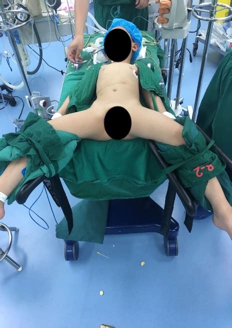 Laparoscopic And Robotic Applications Pediatric Urology Book