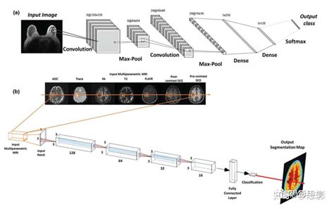 精准医学中的深度学习和影像组学 知乎