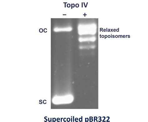 Supercoiled Pbr322 Dna Inspiralis Limited
