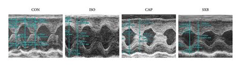Echo Data From The 4 Groups A Typical Echo Screenshots Of Three Download Scientific Diagram