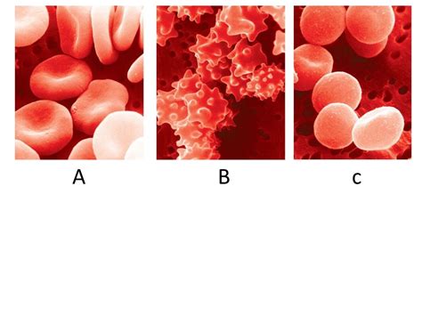 Solved Thanksindicate The Tonicity Of The Solution That The