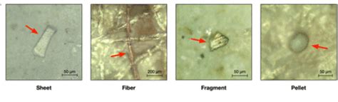 Microplastics Detection In Human Blood Highlighting The Medical Attention