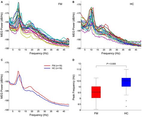 Resting State Oscillatory Brain Activity Superposition Of Individual Download Scientific