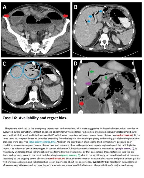 Availability And Regret Bias Download Scientific Diagram