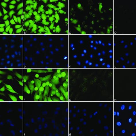 Calcein Acetoxymethyl Ester Staining Immediately After Microwave