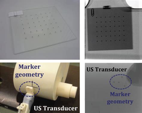 X Ray Calibration Marker At Johnny Moe Blog