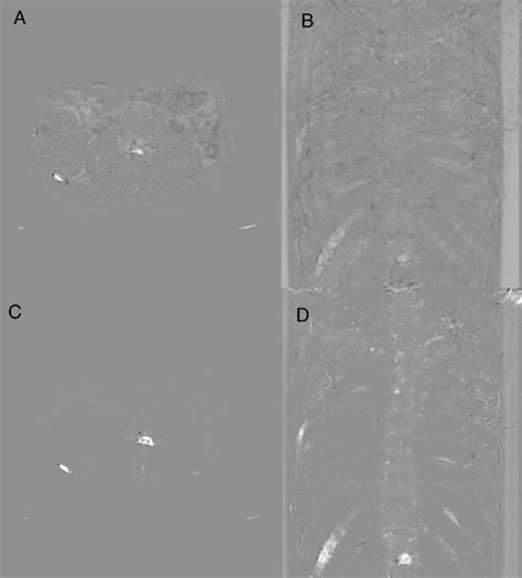 Temporal Subtraction Ts Images Generated Using Our Ts Method And Download Scientific Diagram