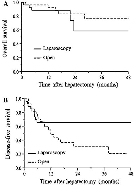 Outcomes Of 56 Patients Who Underwent Right Hepatectomy With Operative
