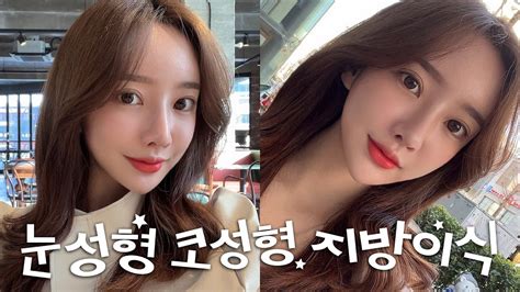 등장하자마자 터지는 함성 눈수술 코수술 얼굴 지방이식 ㅣ프라이빗라운지 Youtube