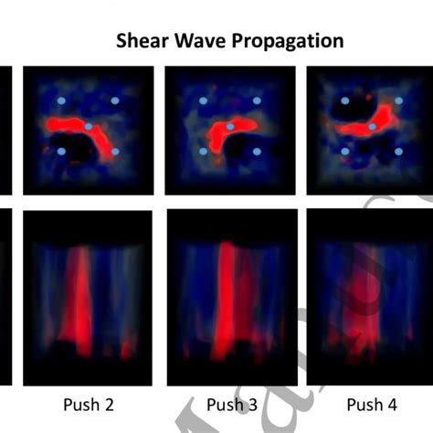 Shear Wave Propagation Results In The Transverse Isotropic Phantom For