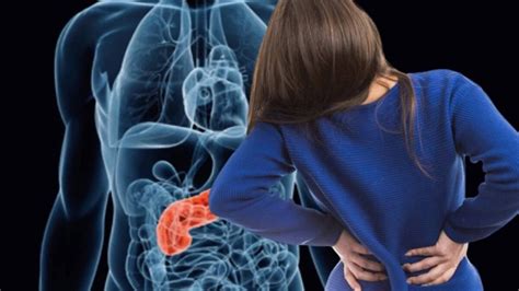 Рак поджелудочной железы эти 2 признака будут видны уже за 3 года до постановки диагноза