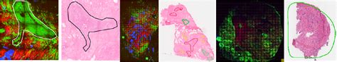 Nonlinear Multispectral Imaging For Tumor Delineation