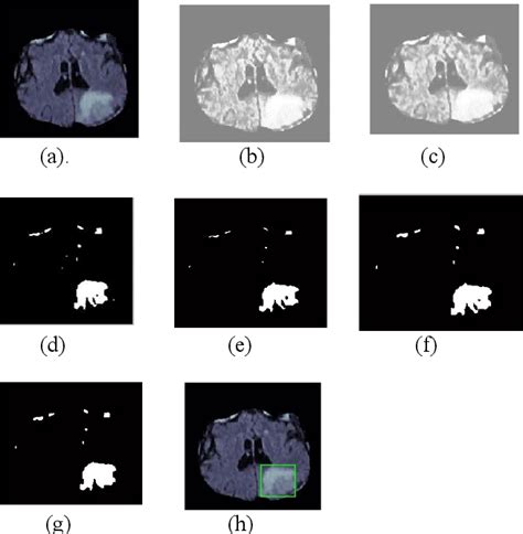 Figure 1 From An Integrated Thresholding And Morphological Process With