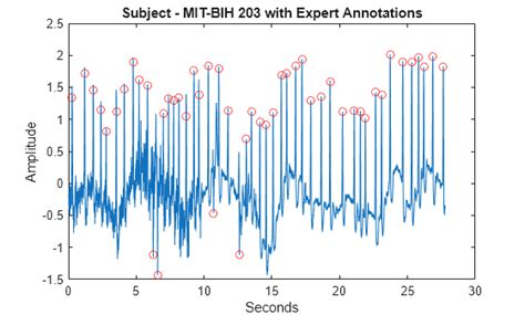wavelet analysis of physiologic signals matlab and simulink example