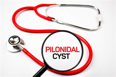 What Is A Pilonidal Cyst A Comprehensive Overview